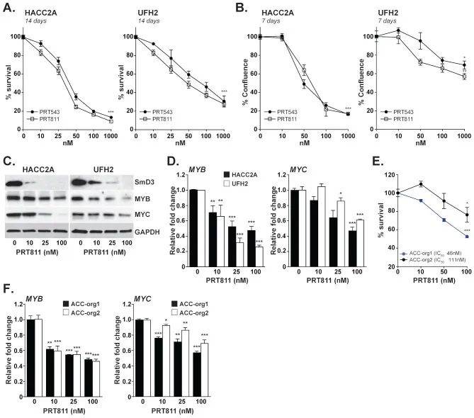JECCR 唾液腺癌类器官模型揭示PRMT5是治疗腺样囊性癌的有效靶点_研究_患者_恶性肿瘤
